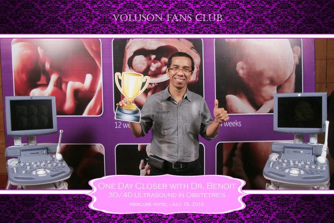 VOLUSON FANS CLUB | The Caramel's Corner | Bridestory